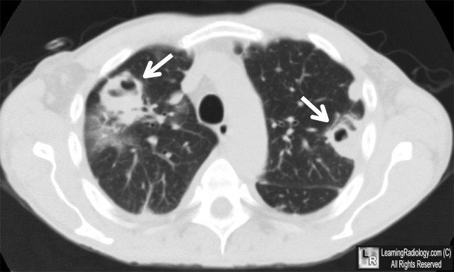 Learningradiology
